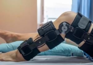 10 Preguntas clave sobre la inestabilidad rotuliana